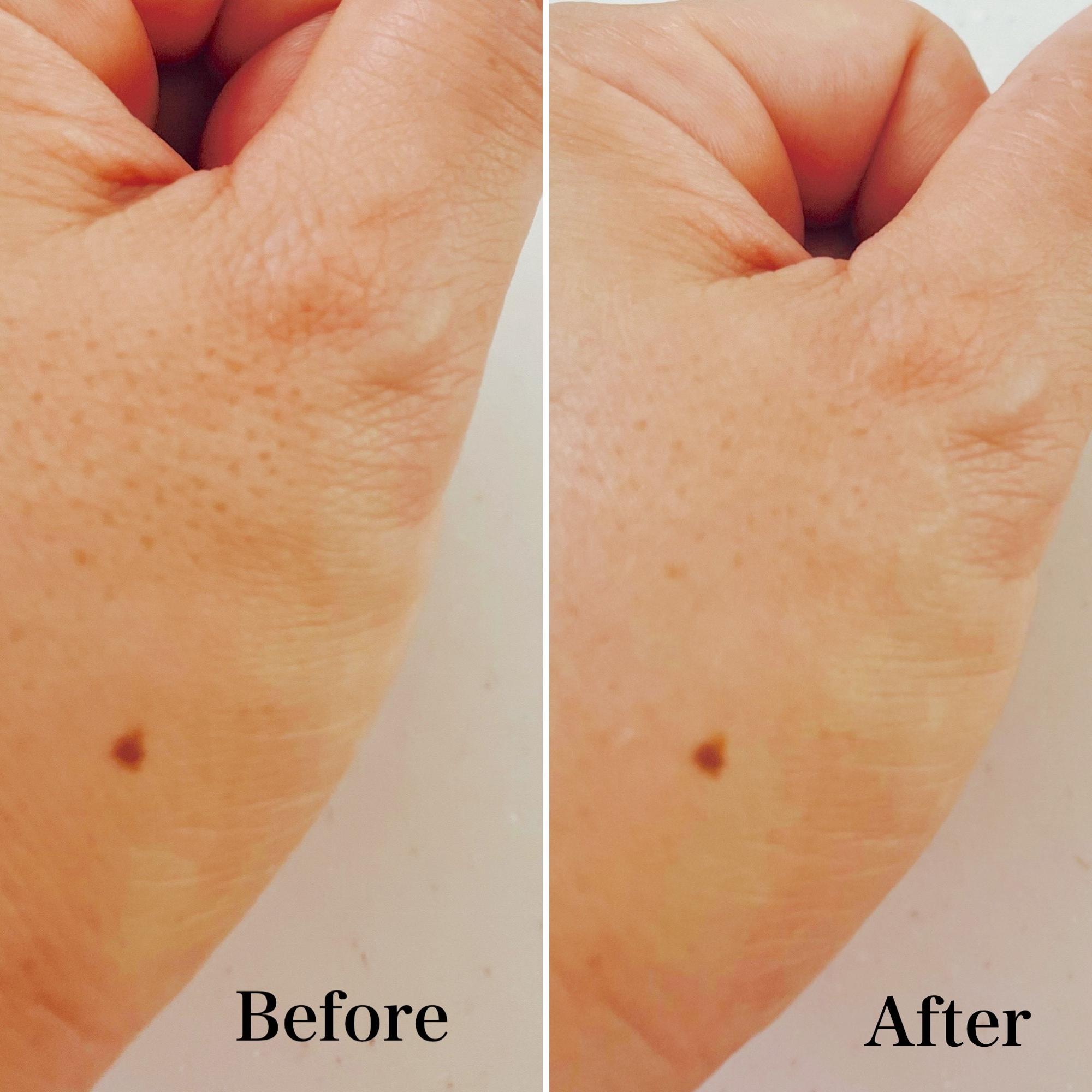 【ダイソー】毛穴が気になる方に朗報！ダイソーがスゴイの出して来たっ！（100style） - エキスパート - Yahoo!ニュース