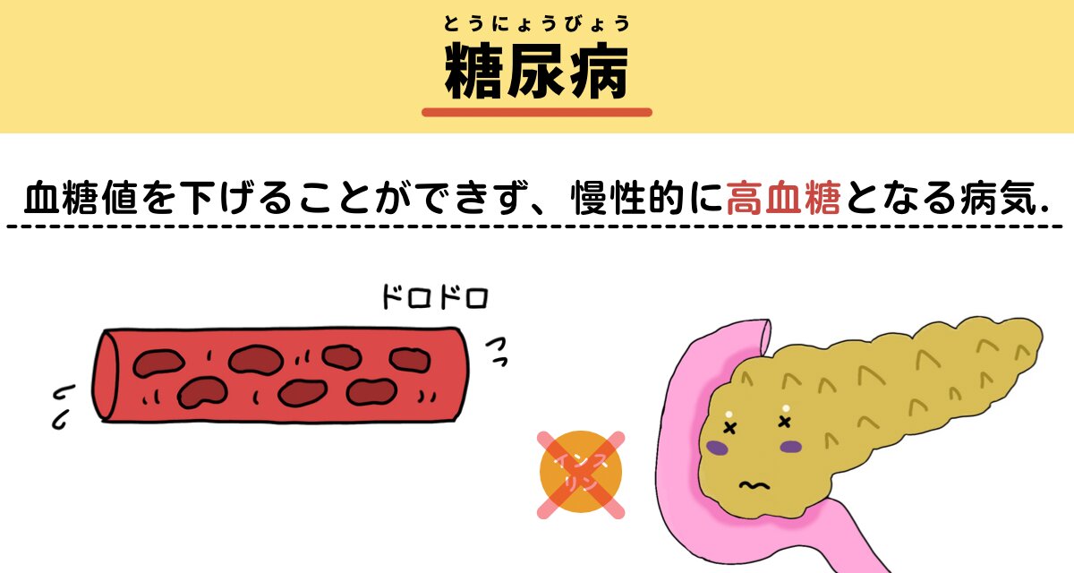 【糖尿病になると現れる初発症状5選！】 その症状は糖尿病のサインかも？ （おがちゃん先生） エキスパート Yahooニュース