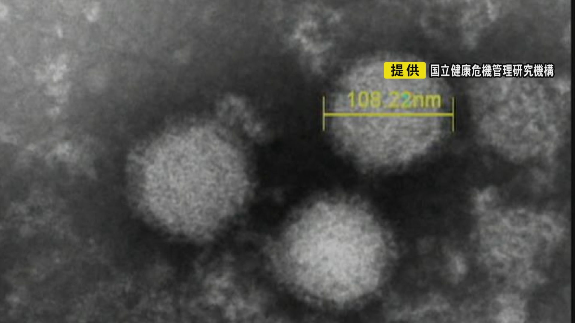 マダニに噛まれた事が原因か…感染症『SFTS』で男女2人が死亡 うち1人は感染疑いの時期に草むら等での行動歴なし（東海テレビ） - Yahoo!ニュース