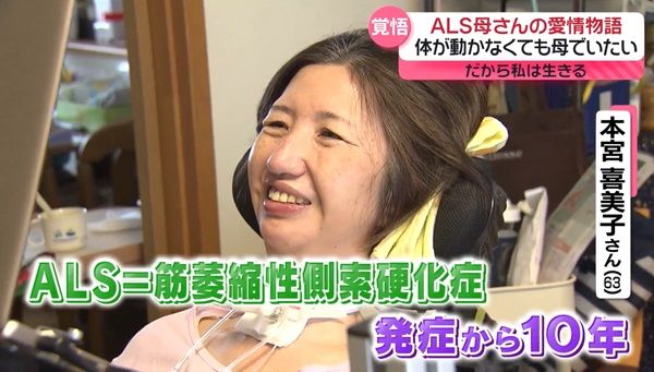 難病ALS 体が動かなくても「母でいたい」…息子の一言で“生きる覚悟” 晴れ姿を見せた娘「ずっと自慢の母」『every.特集』（日テレNEWS NNN） - Yahoo!ニュース