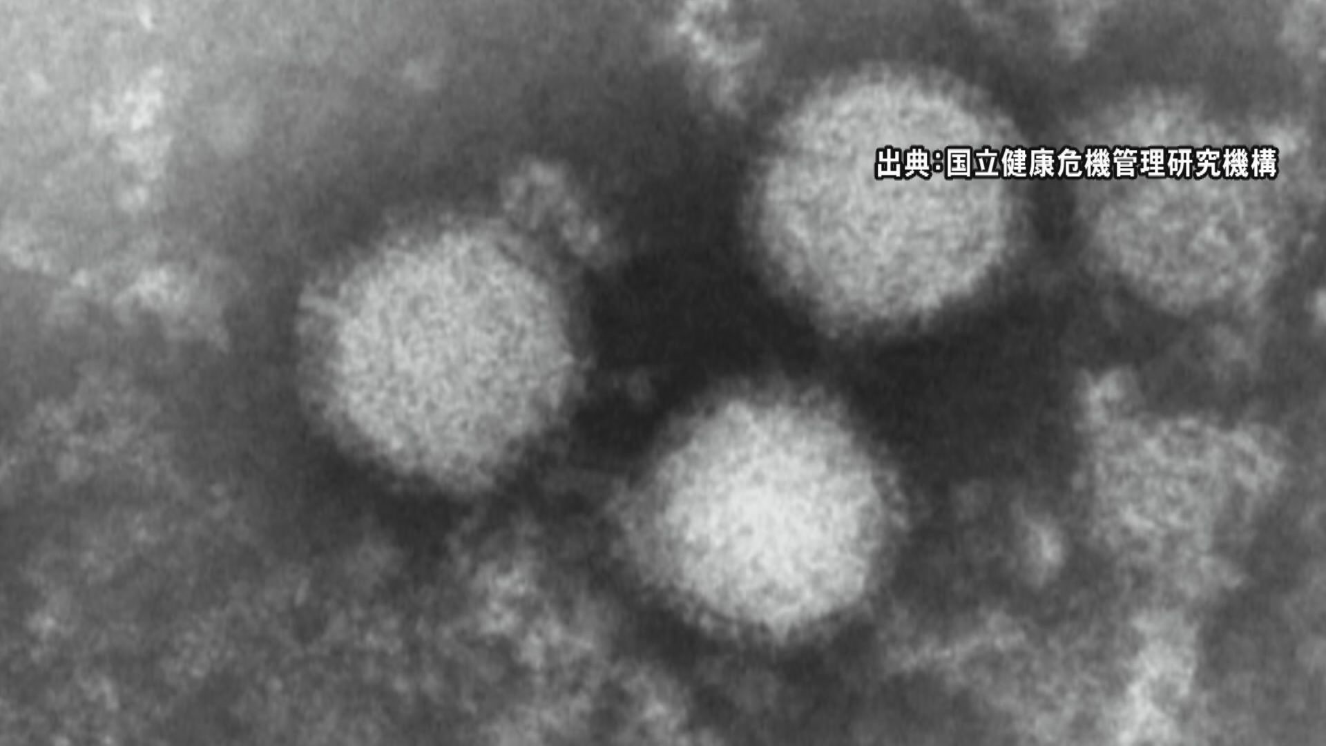 草刈り後に腕の“マダニ”に気づく…感染症『SFTS』岐阜で初の患者確認 女性が発熱など訴え複数の病院を受診し判明（東海テレビ） - Yahoo!ニュース