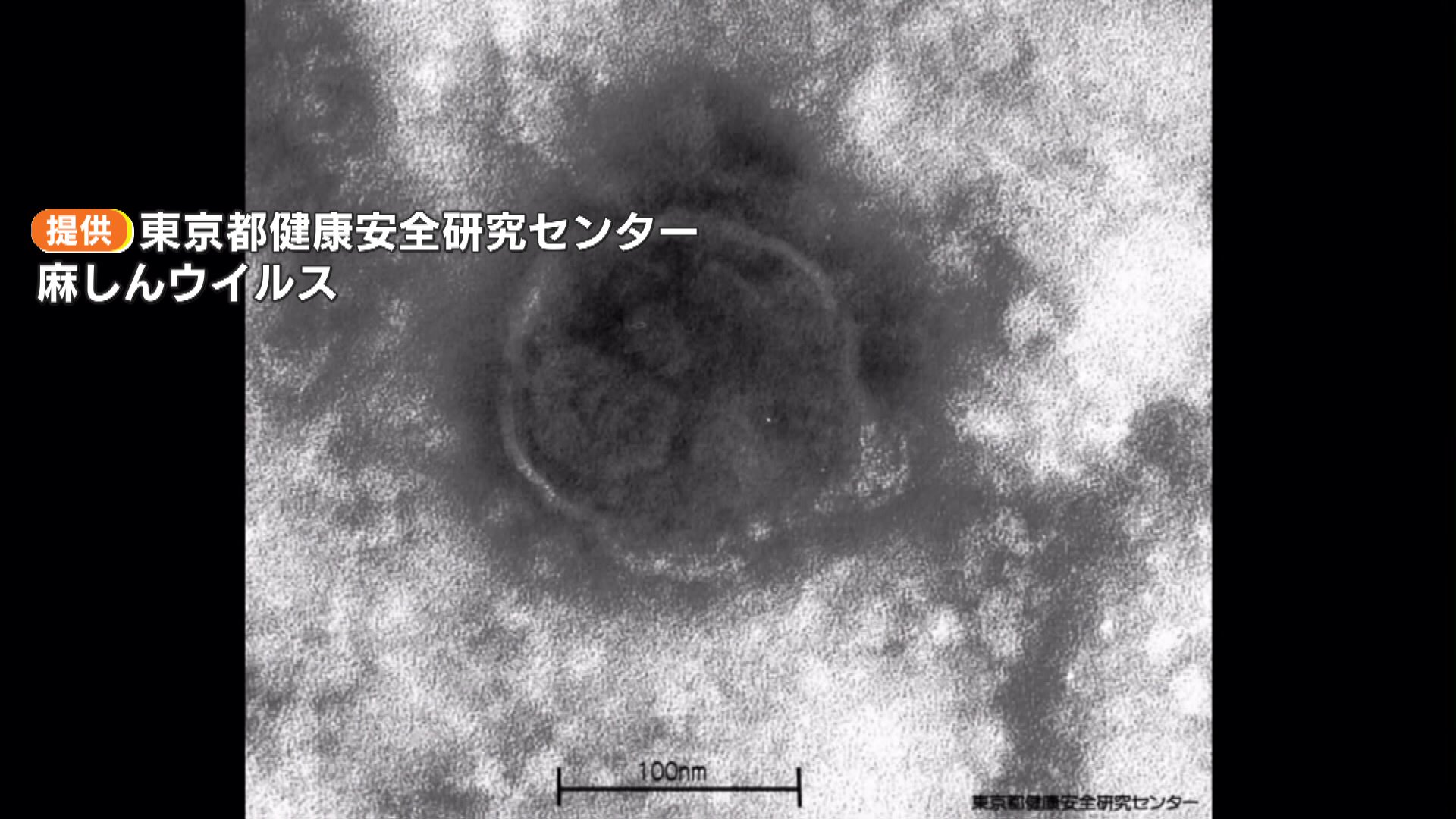 空気感染する「はしか」今後の広がりに注意を 福岡県では8月に5人が発症 すでに二次感染も（RKB毎日放送） - Yahoo!ニュース