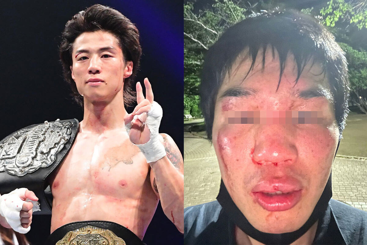“不起訴でも許せない” K-1チャンピオンの「身の毛もよだつ暴行動画」に批判殺到 K-1プロデューサーに就任した須藤元気氏に見解を質したが「返答なし」（デイリー新潮） - Yahoo!ニュース